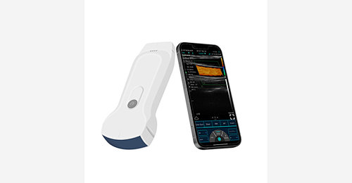C10RL wireless ultrasound, hand held ultrasound | Sonosee