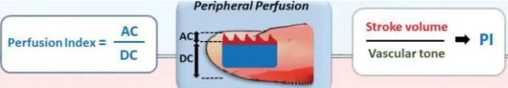 More Than SpO₂ —What the Perfusion Index (PI) Truly Reveals