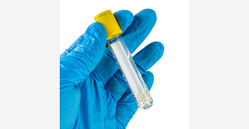 Yellow Blood Collection Tube - Yongkang Medical