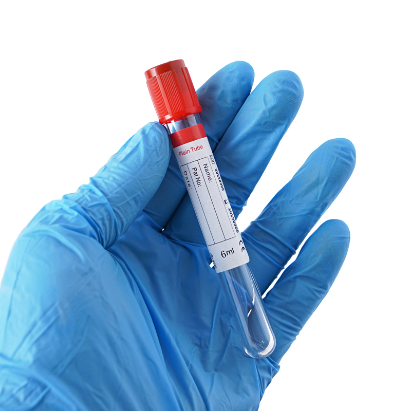 Serum Plain Tube - Yongkang Medical