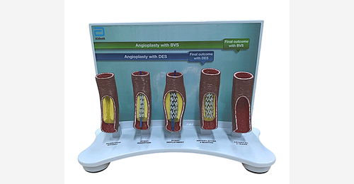 artery stent model , Human vascular stent model , medical stent model
