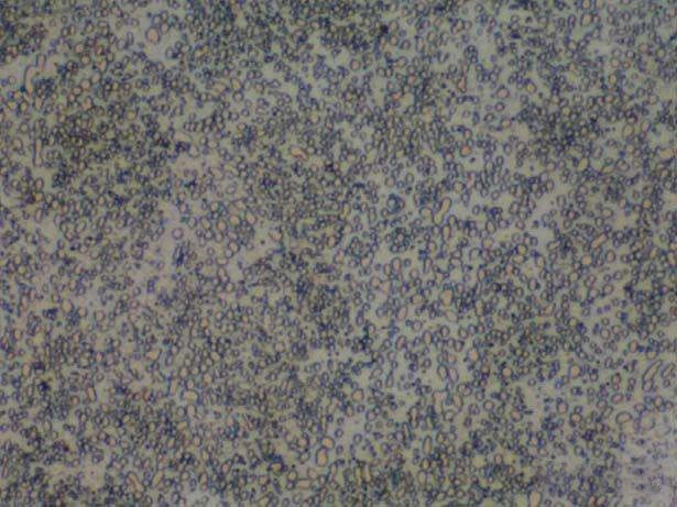 Names and characteristics of common metallographic structures - SY Metals