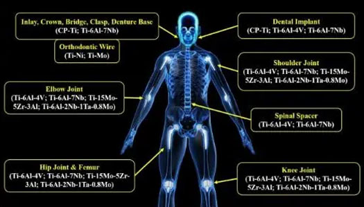 Application of titanium alloy in biomedical field - Lork Group Co., Ltd