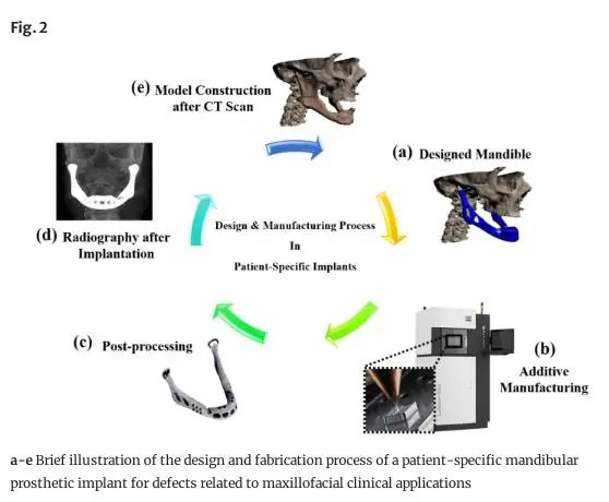 Application of titanium alloy in biomedical field - Lork Group Co., Ltd