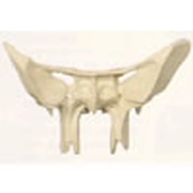 Sphenoid Bone